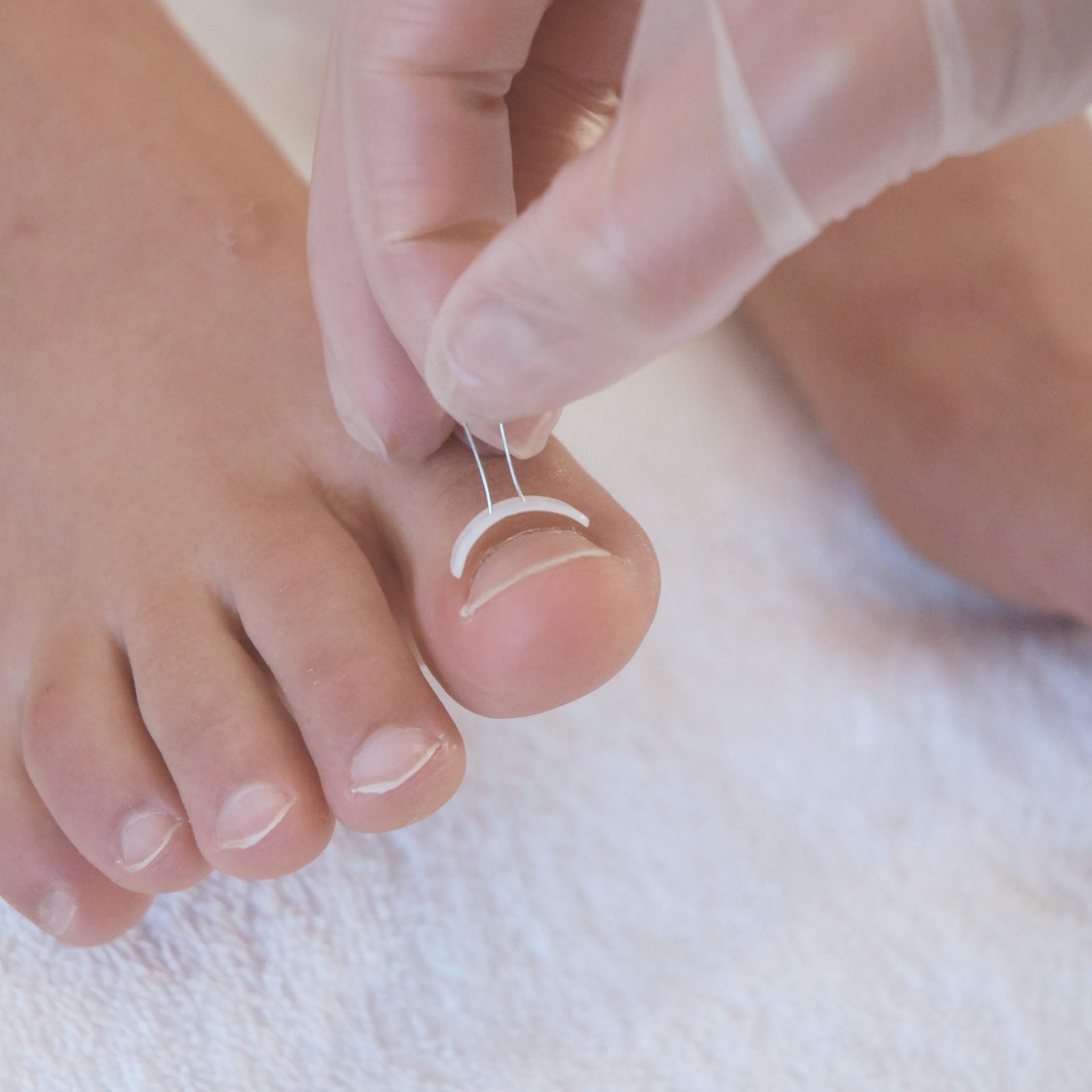 Informatie – Pedicure Den Haag | Nove Clinic